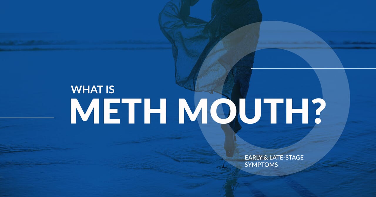 What Is Meth Mouth? Causes, Effects, & Prevention Tips